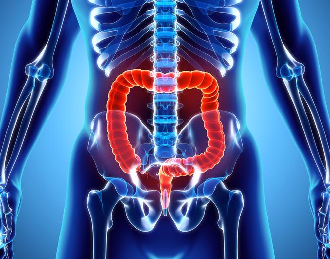 Como LIMPAR O CÓLON naturalmente - REMÉDIOS EFICAZES