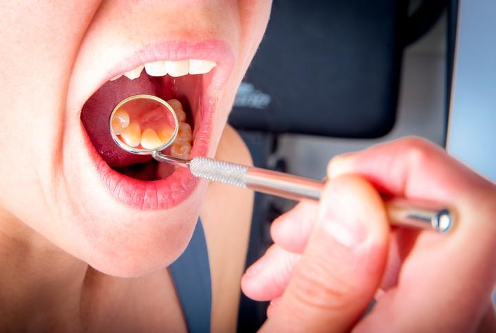 Céu Da Boca Inchado: O Que Pode Ser E Como Tratar – OYIM