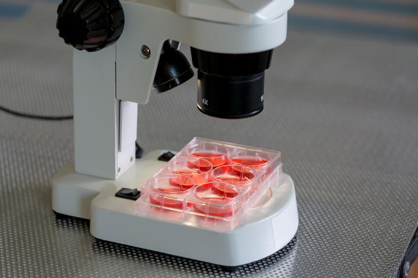 O que é RDW - interpretando a análise de sangue